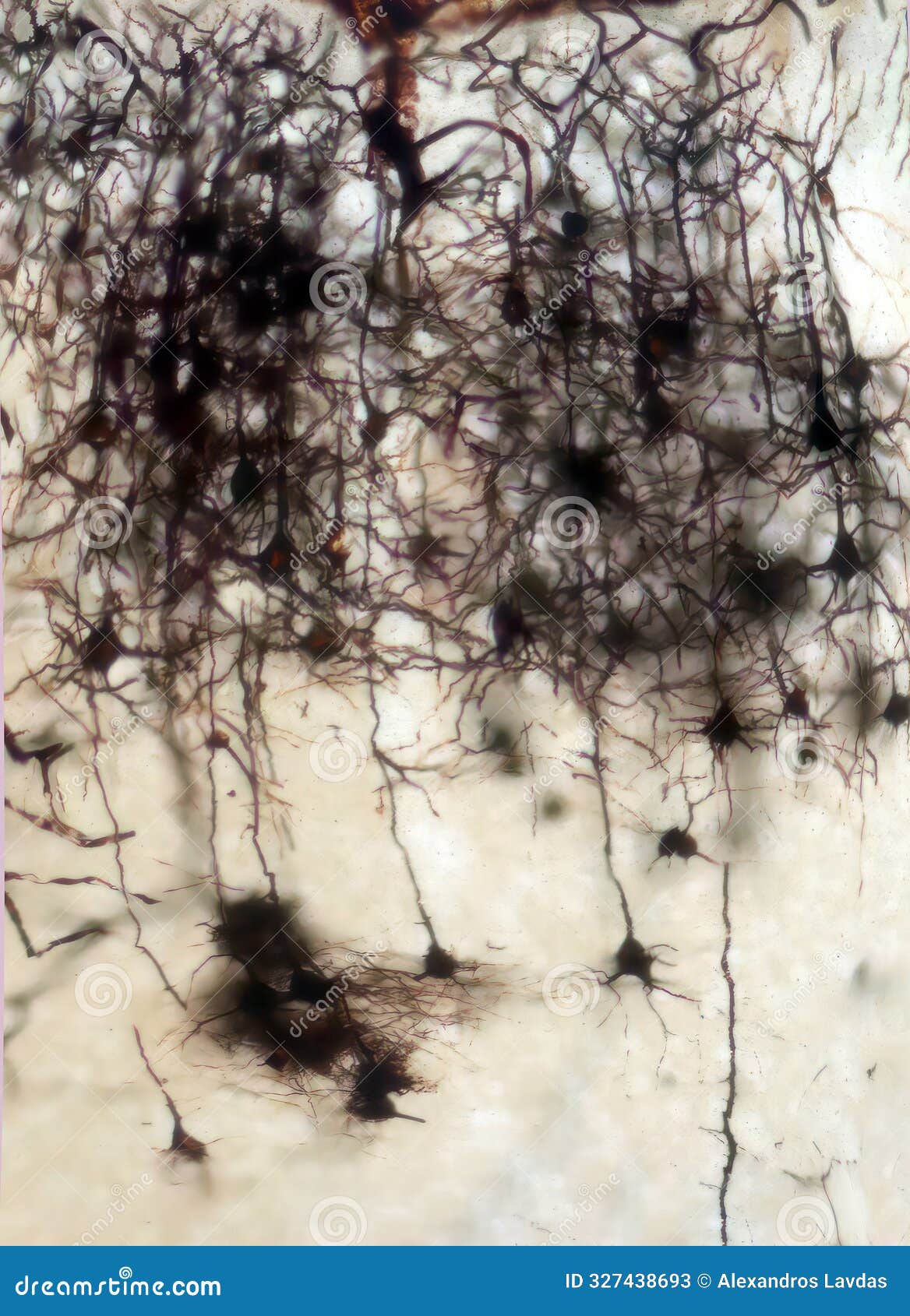 Golgi stain, brain stock image. Image of microscopy - 327438693