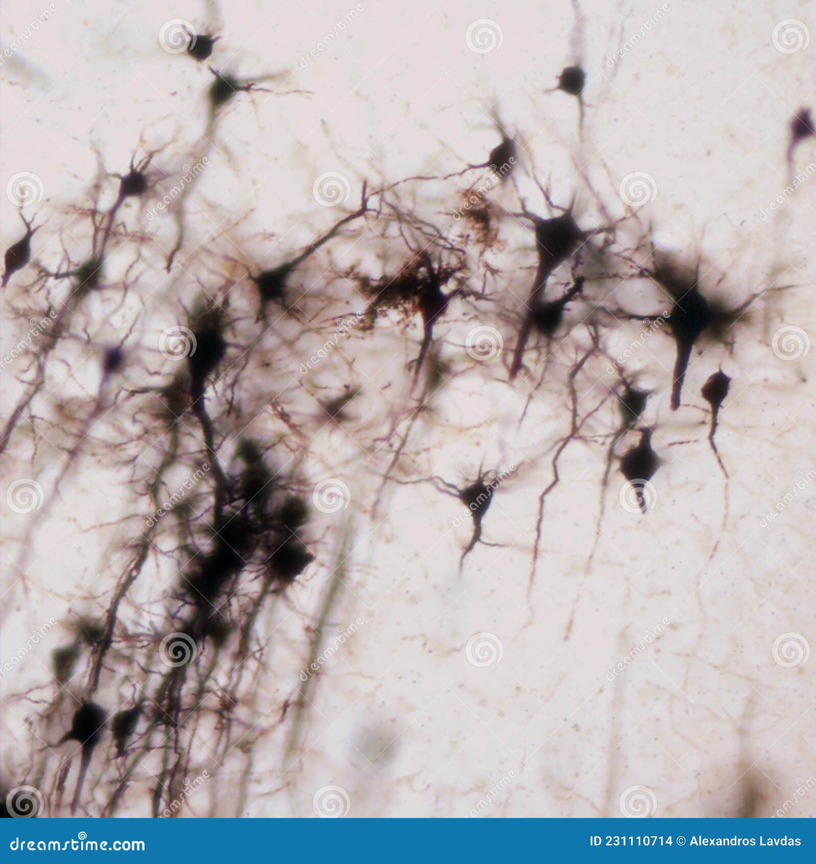 Golgi Stain of Mouse Brain Section Stock Photo - Image of brain ...