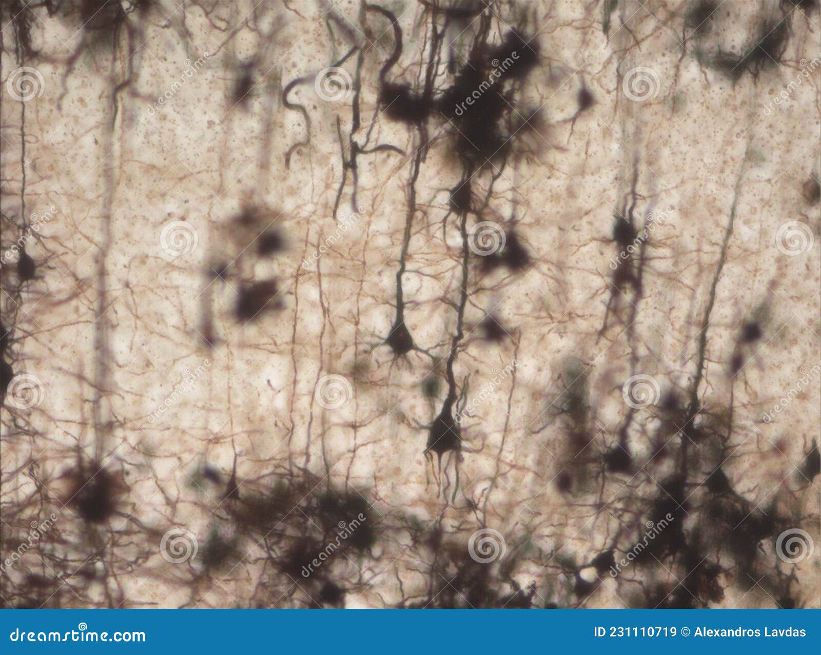 Golgi Stain of Mouse Brain Section Stock Image - Image of black, vessel ...