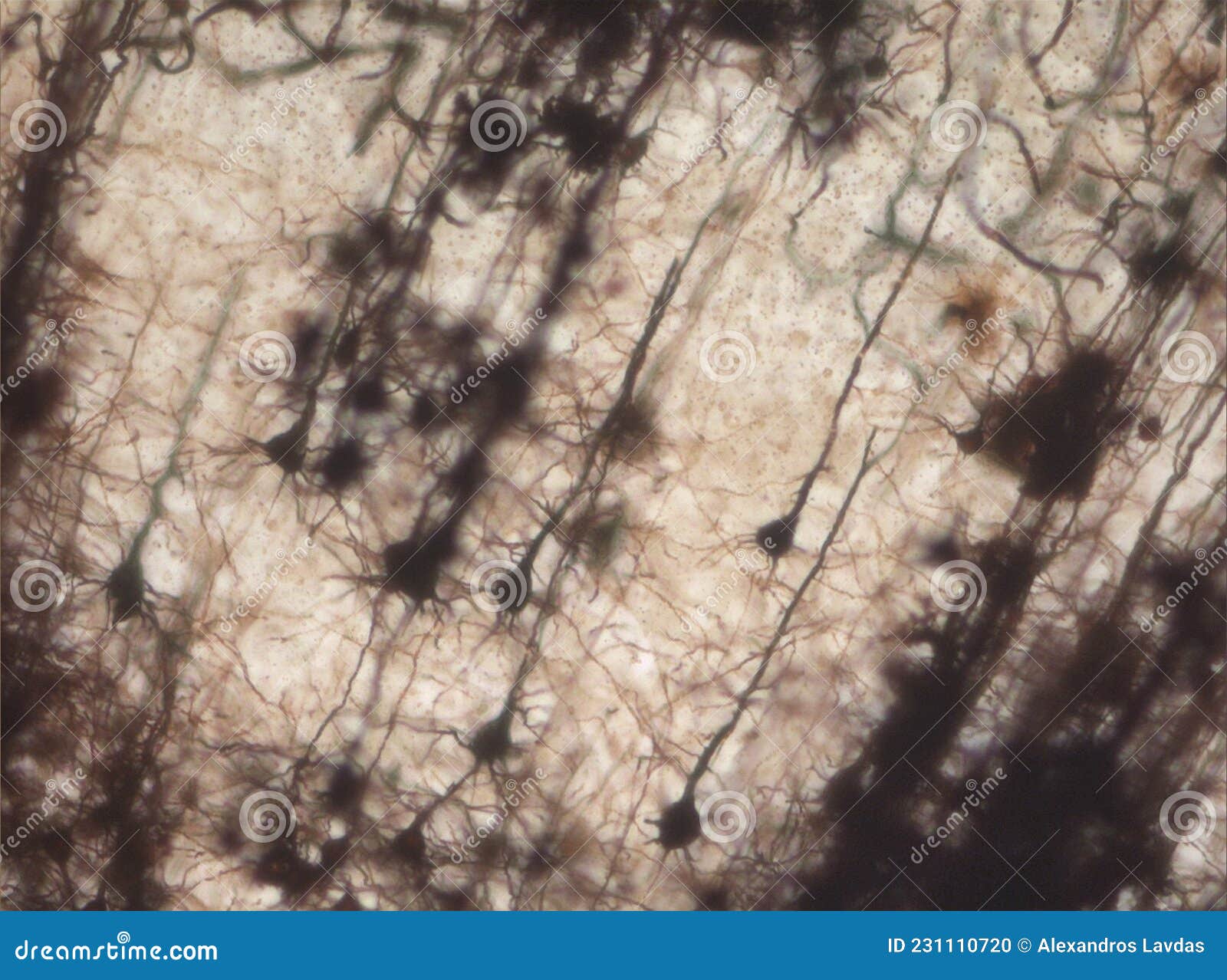 Golgi Stain of Mouse Brain Section Stock Photo - Image of stained ...