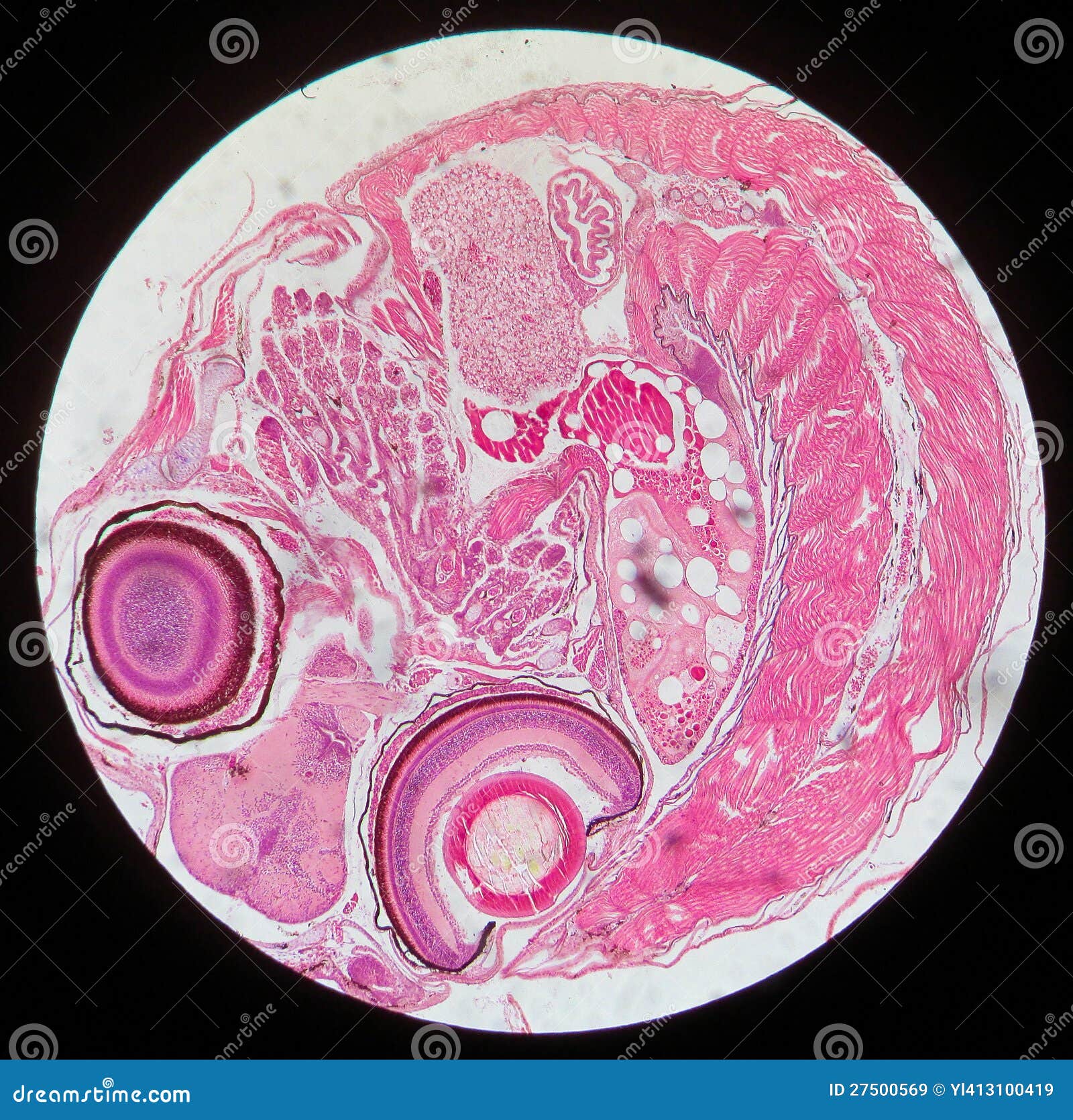 The gonad and embryo stock image. Image of organism, model - 27500569