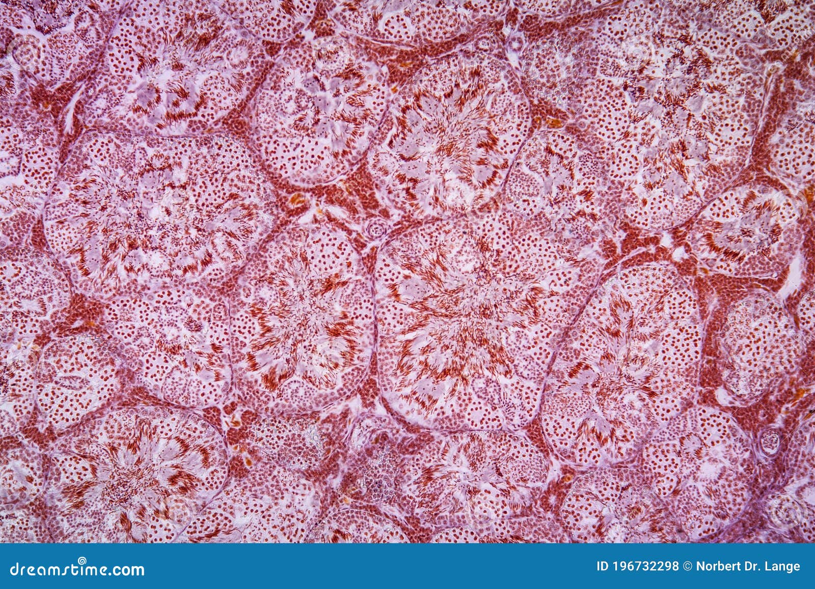 Gonadi con sperma fotografia stock. Immagine di microscopia - 196732298