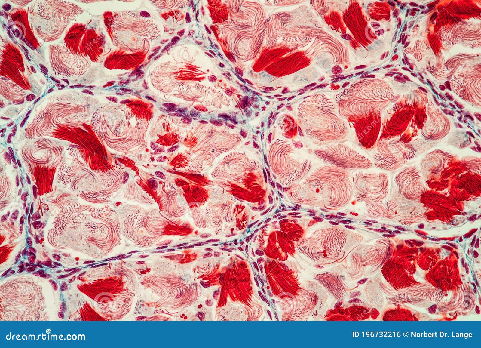 Rat Testicles With Sperm Tissue In Cross Section Royalty-Free Stock ...