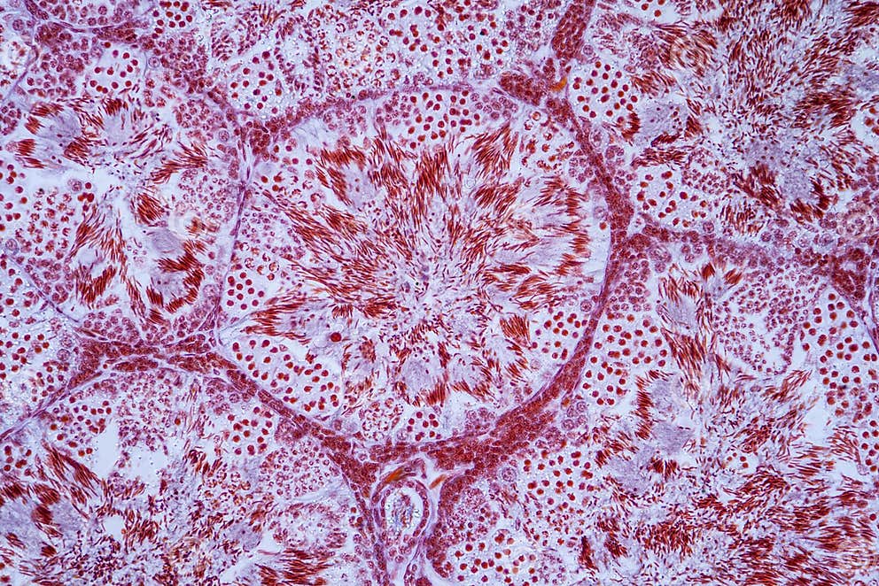 With sperm stock image. Image of glands, histology, magnifying - 196732427