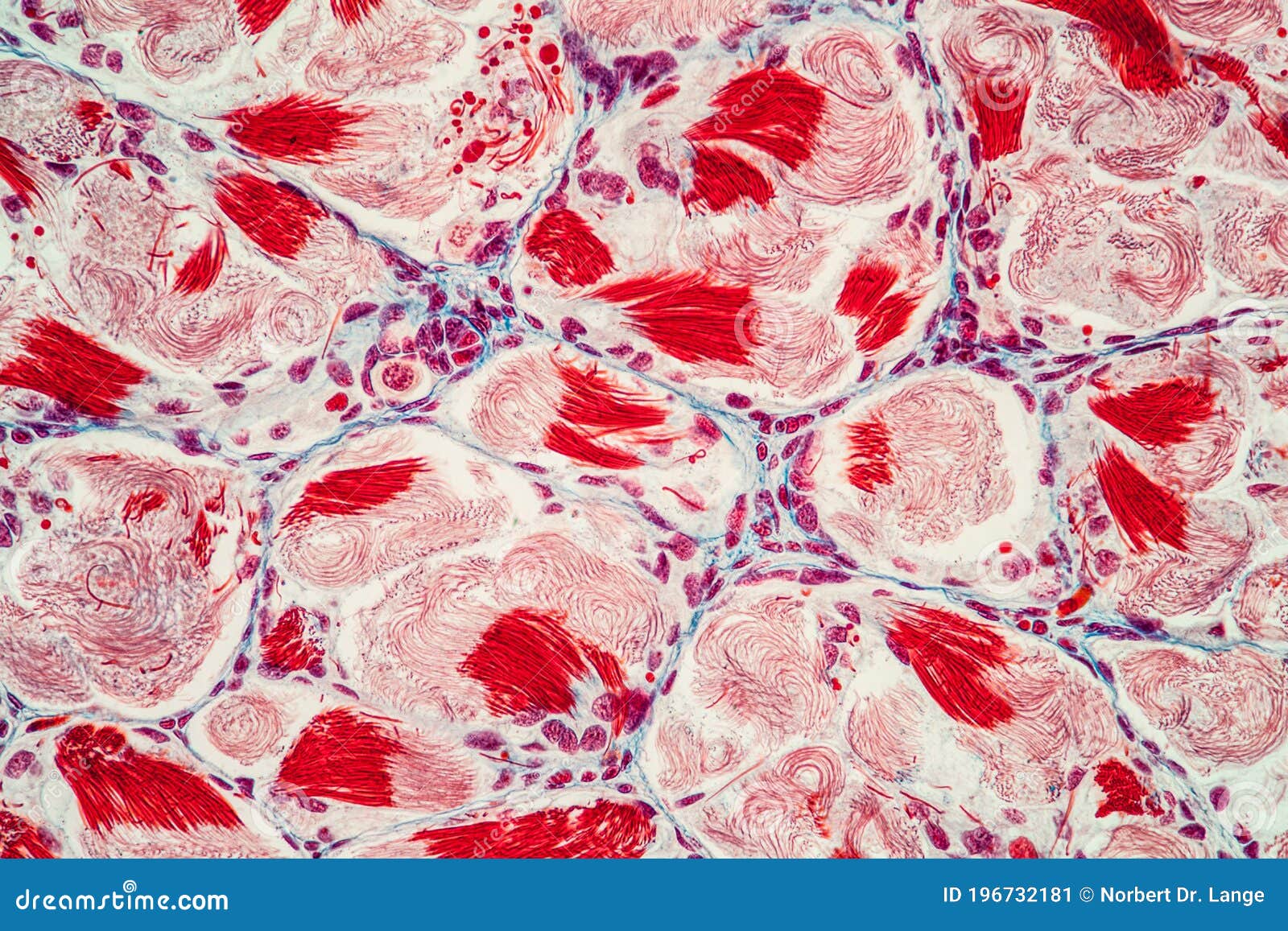 Rat Testicles With Sperm Tissue In Cross Section Royalty-Free Stock ...