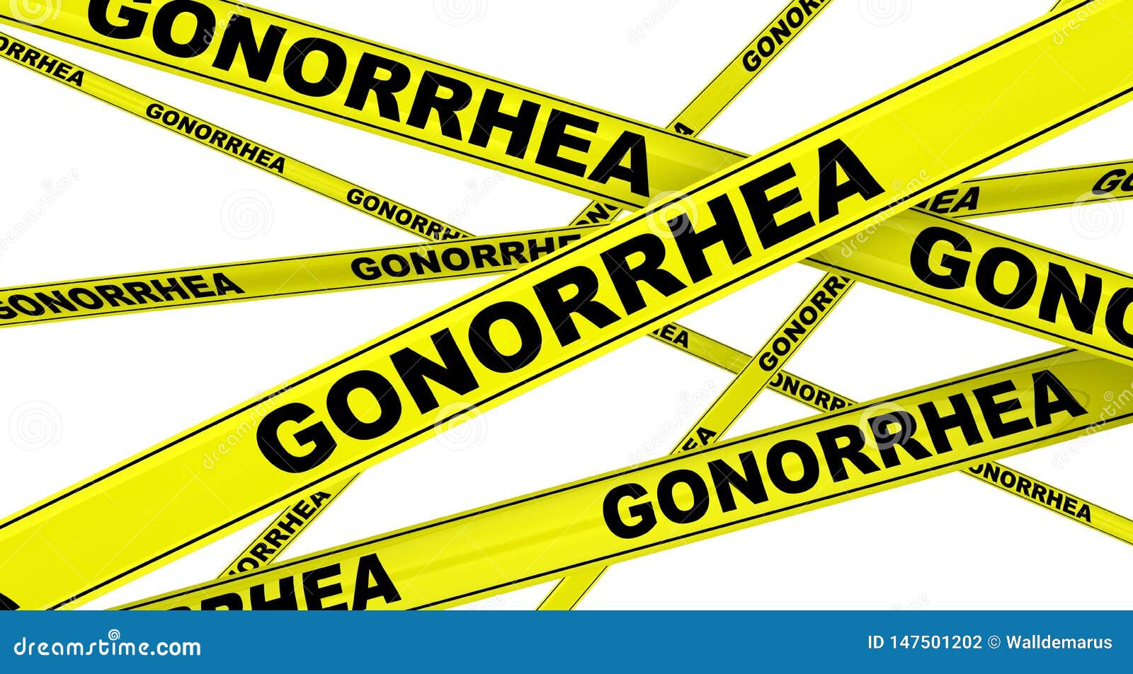Gonorrhea Is A Sexually Transmitted Infection Caused By The Bacterium