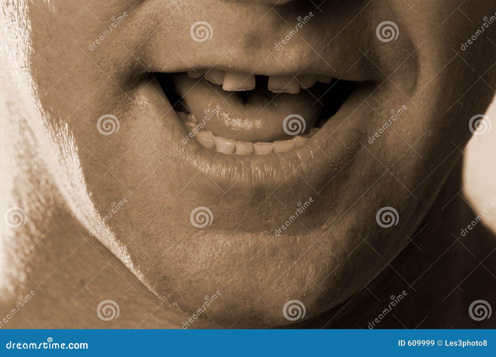 Goofy Smile Stock Image Image Of Male Goofy Veneers 609999