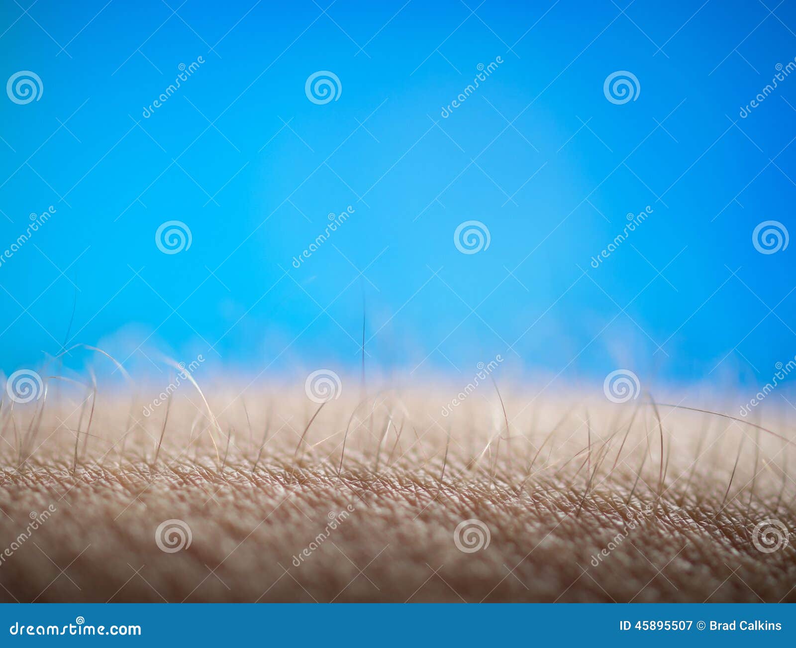 Goose Bumps On Human Skin Stock Photography | CartoonDealer.com #84142724