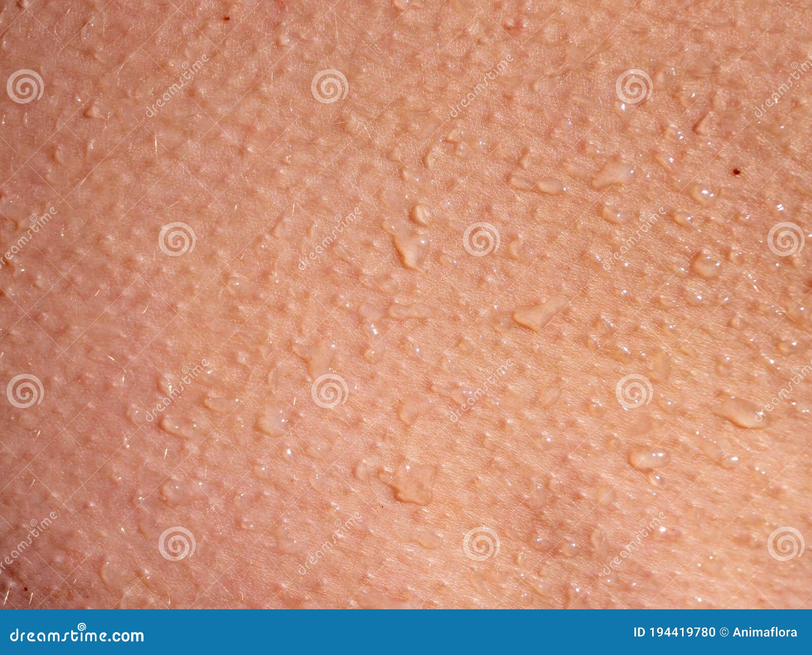 Goose Bumps With Water Drops Texture Royalty-Free Stock Image ...