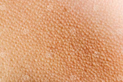 Goosebumps Skin Background stock photo. Image of goosebump - 6112842