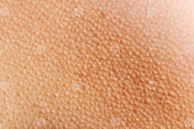 Goosebumps Skin Background stock photo. Image of goosebump - 6112842