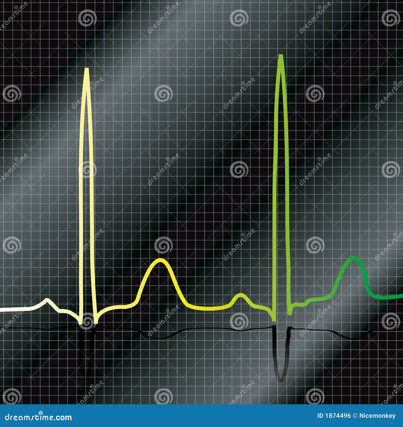 Gradient ecg stock illustration. Illustration of chart - 1874496