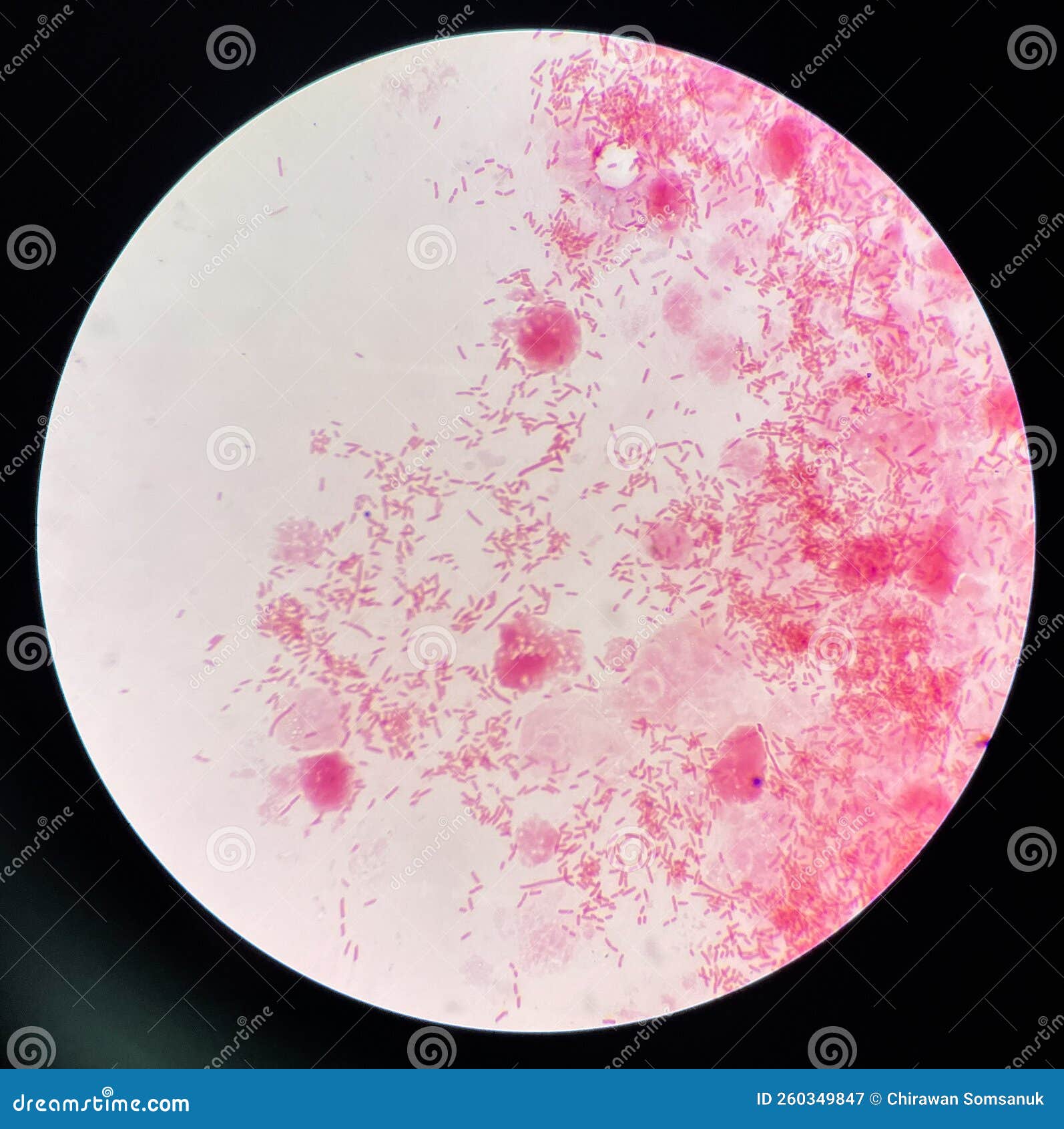 Gram Neagtive Bacilli on Slide Stock Image - Image of colony, cells ...
