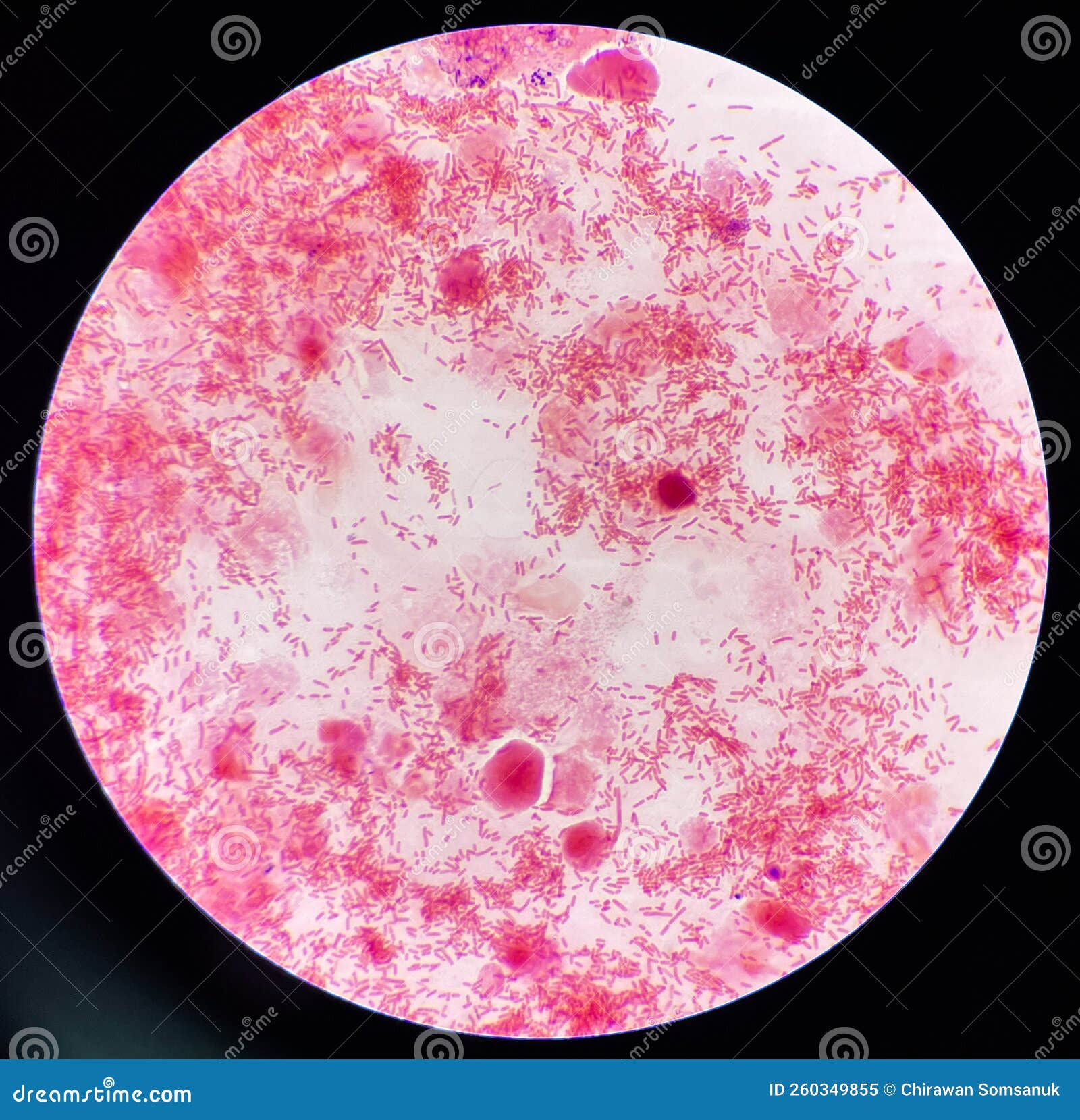 Gram Neagtive Bacilli on Slide Stock Image - Image of flora ...
