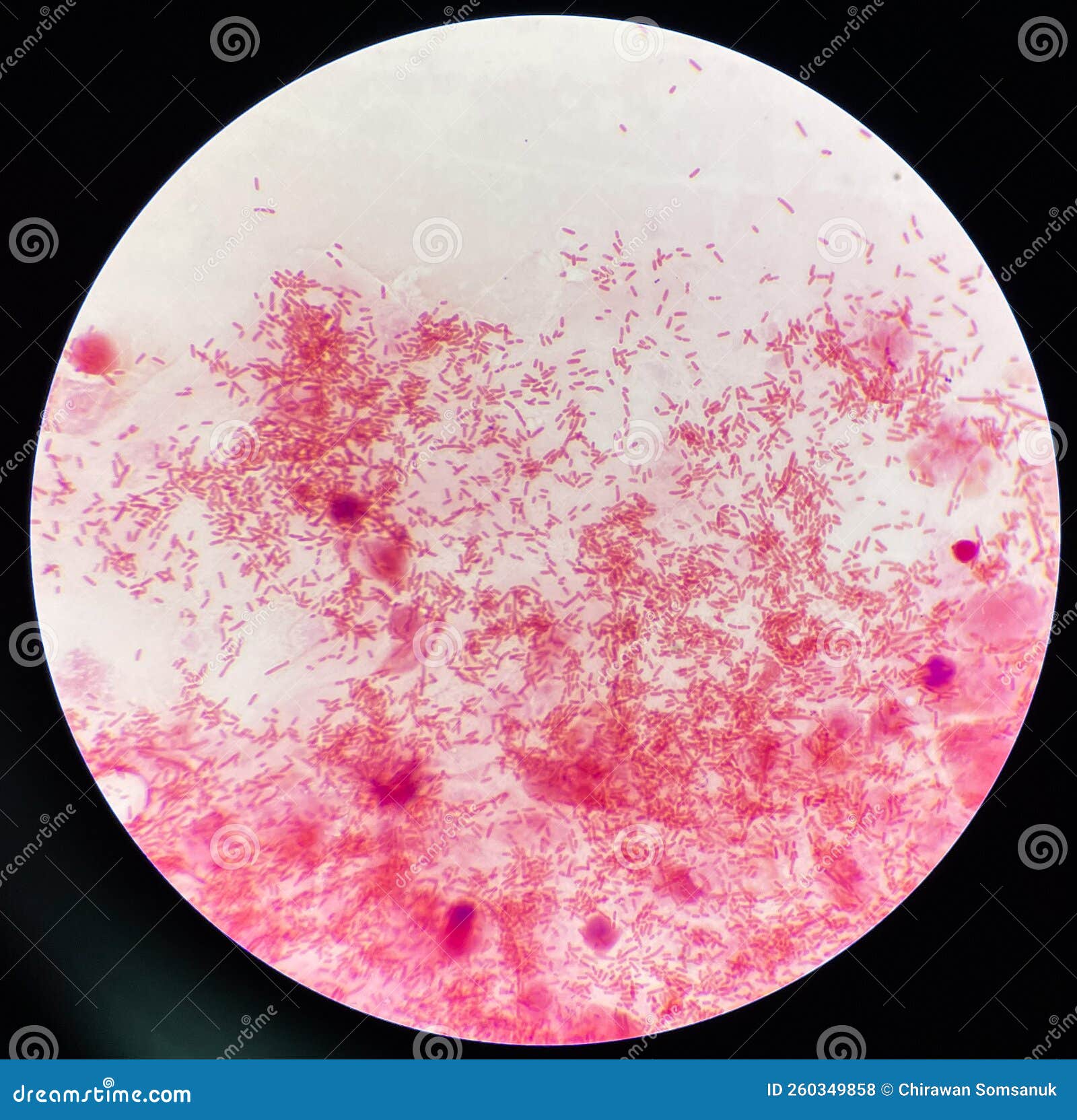 Gram Neagtive Bacilli on Slide Stock Photo - Image of infection ...