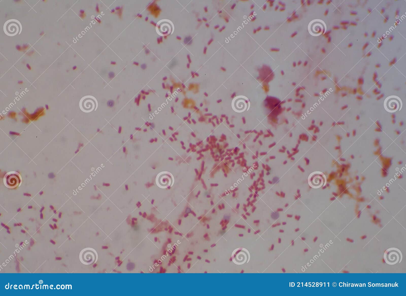 Legionella Pneumophila Background. Gram-negative Bacillus That Causes ...