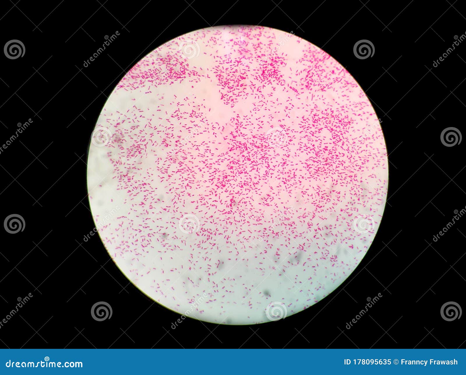 Gram Negative Bacillus. Gram Stain Stock Image - Image of smear ...