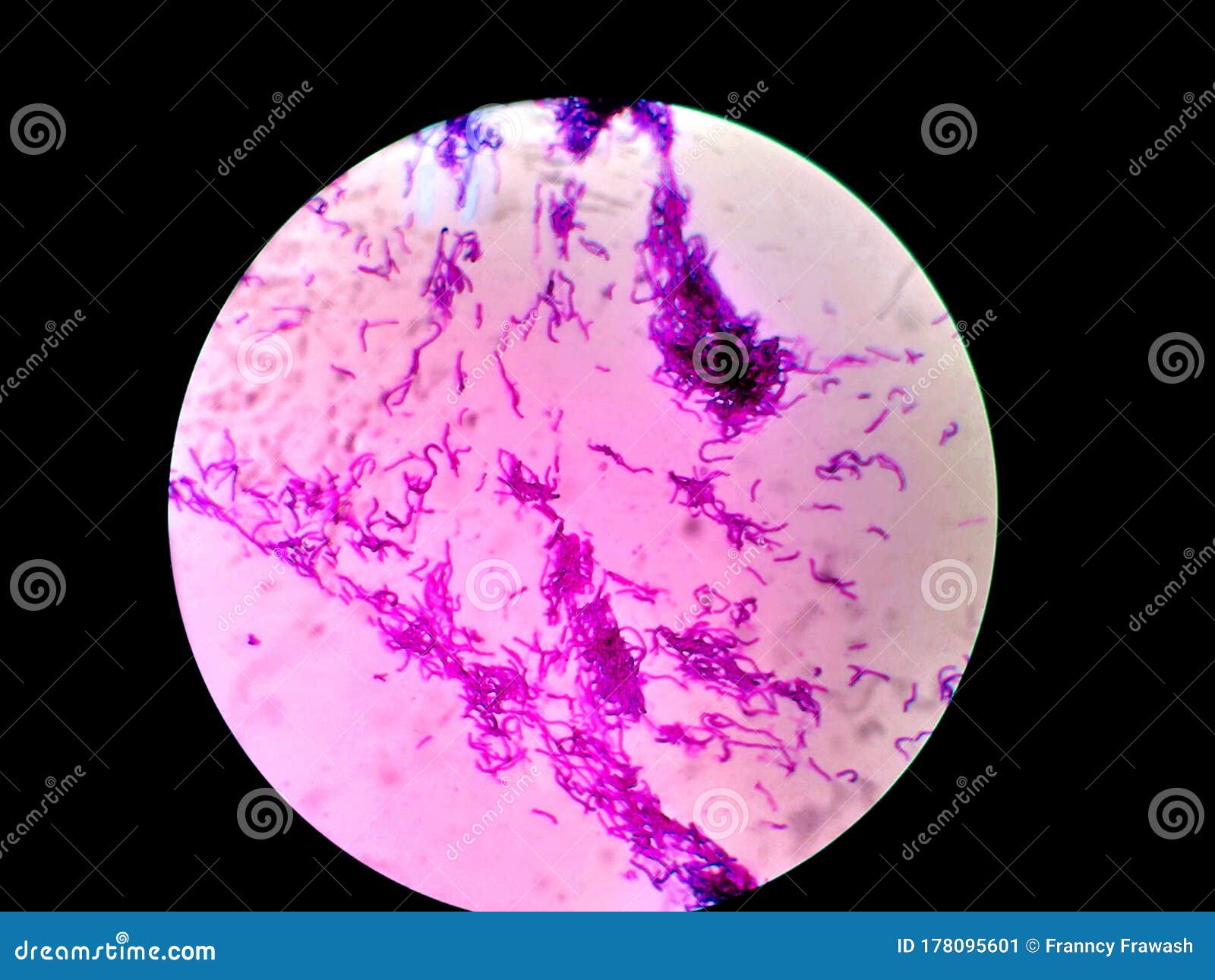 Gram Negative Bacillus. Gram Stain Stock Image - Image of microbiology ...