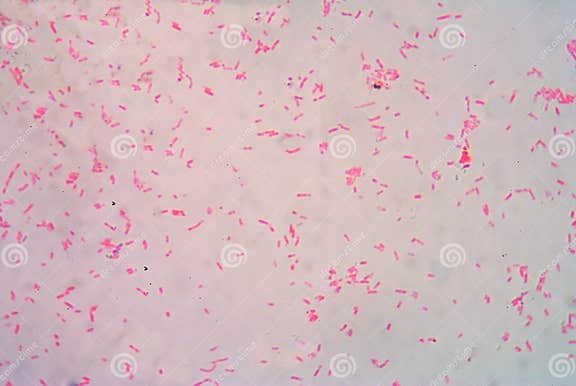 Gram negative. stock photo. Image of research, microbiology - 50804640