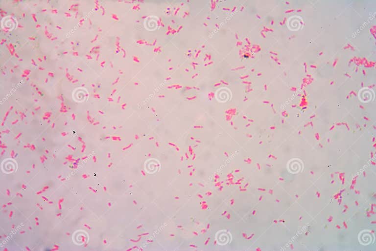 Gram negative. stock photo. Image of research, microbiology - 50804640
