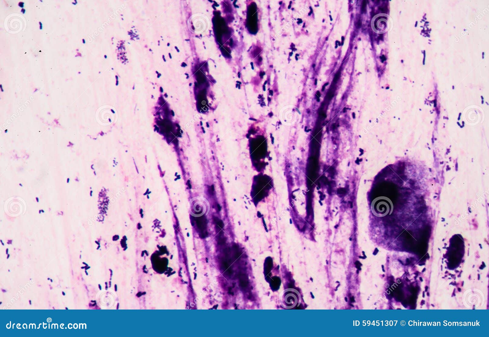 Gram Positive Bacilli Bacteria. Stock Image - Image of medical, aids ...