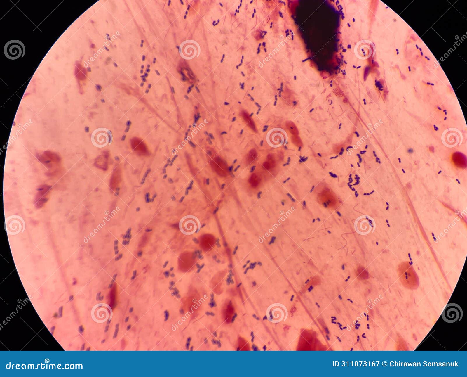 Gram Positive Bacilli in Sputum Stock Image - Image of harmful, disease ...