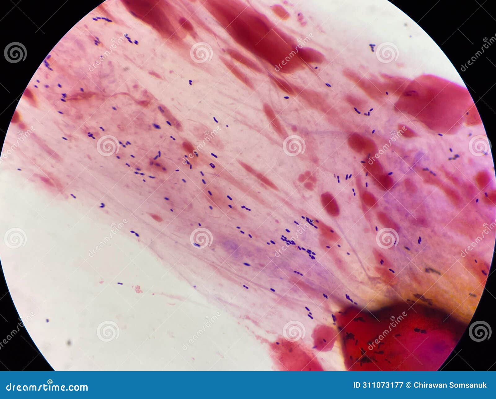 Gram Positive Bacilli in Sputum Stock Image - Image of bacterium ...