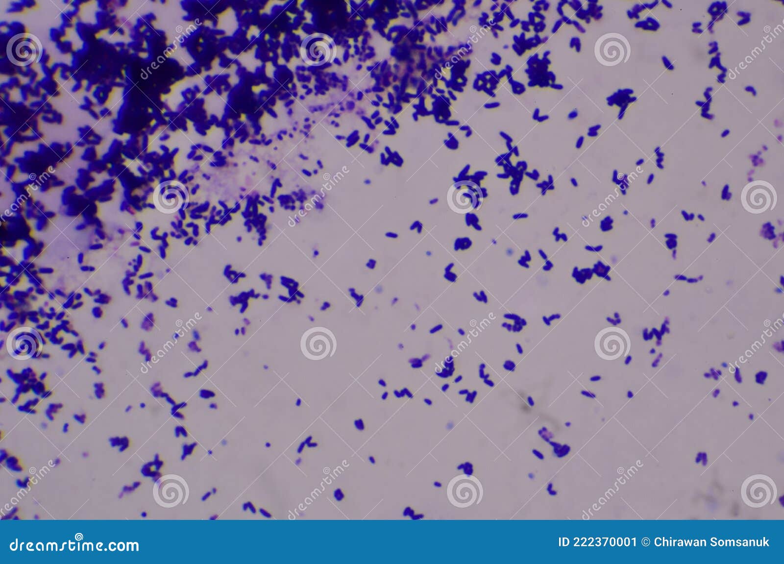 Gram Positive Baclli Chines Letter Finding with Microscope Stock Image ...