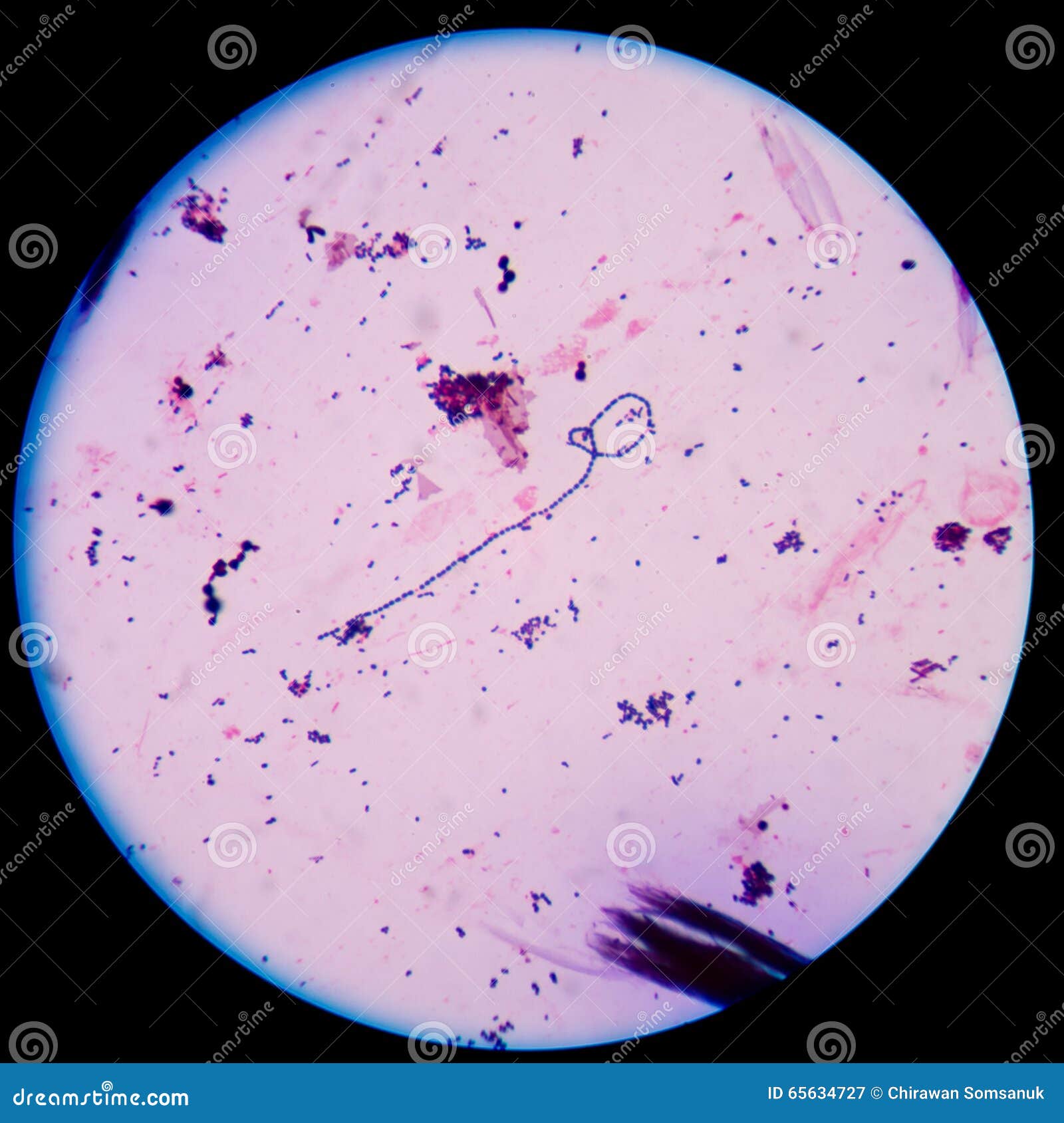 Gram positive cocc. stock image. Image of microbe, medicine - 65634727