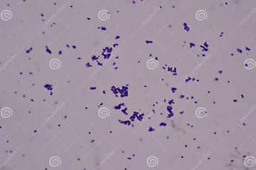 Gram Positive Cocci Finding with Microscope Stock Image - Image of ...