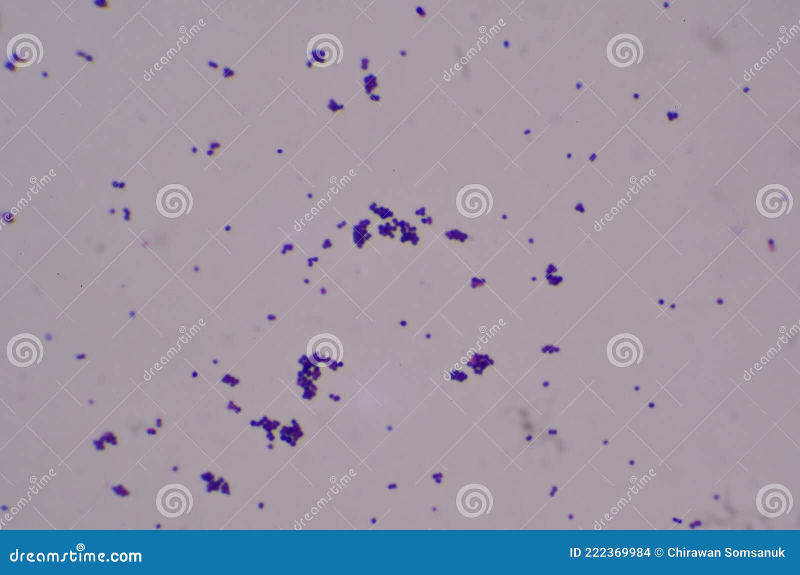 Gram Positive Baclli Chines Letter Finding With Microscope Stock Photo ...