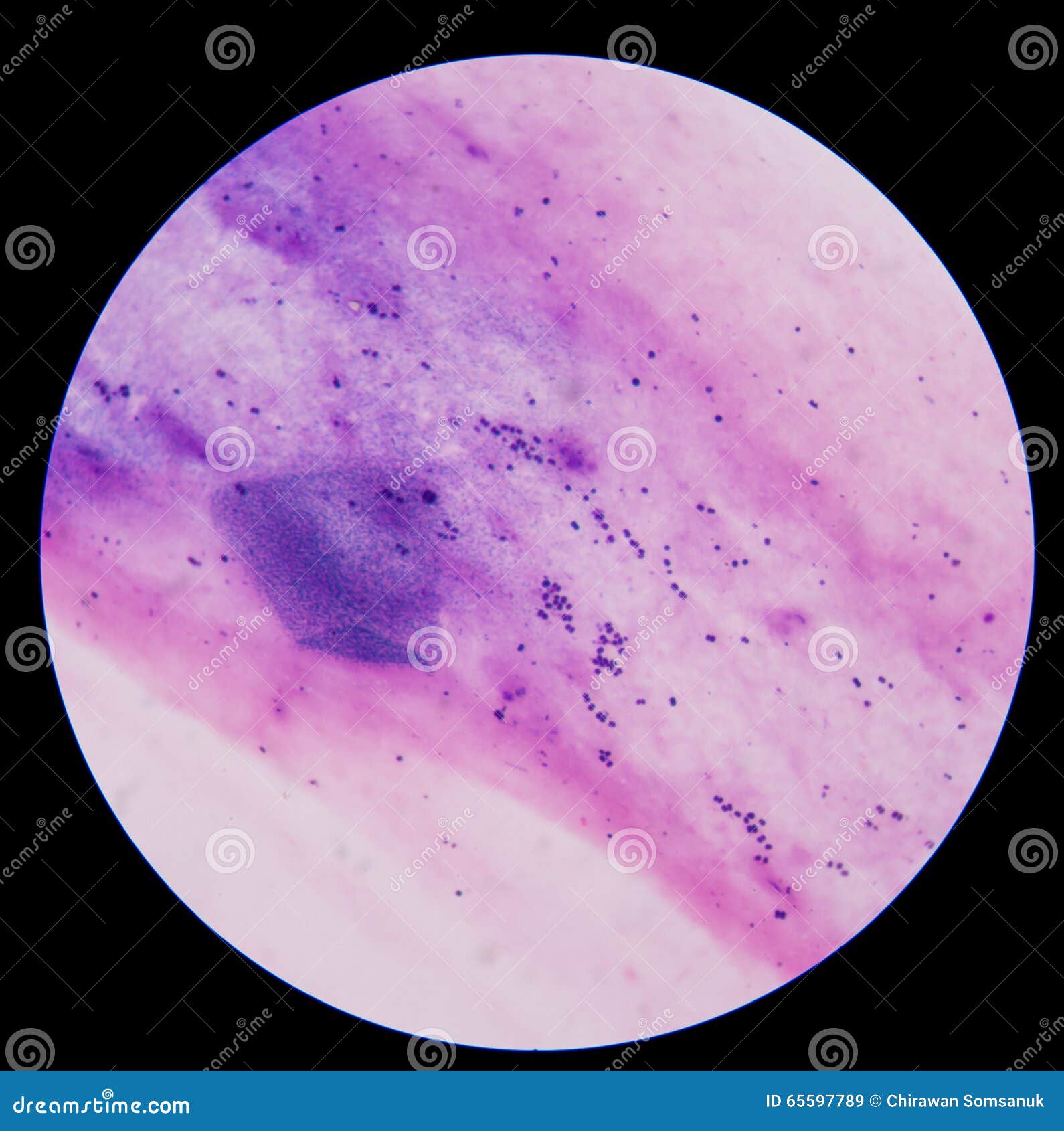 Gram positive cocci stock image. Image of methicillin - 65597789