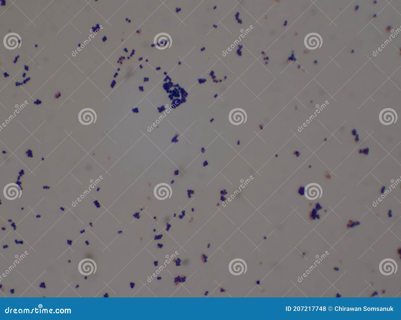 Gram Stain Gram Positive Cocci Stock Photo - Image of healthcare ...