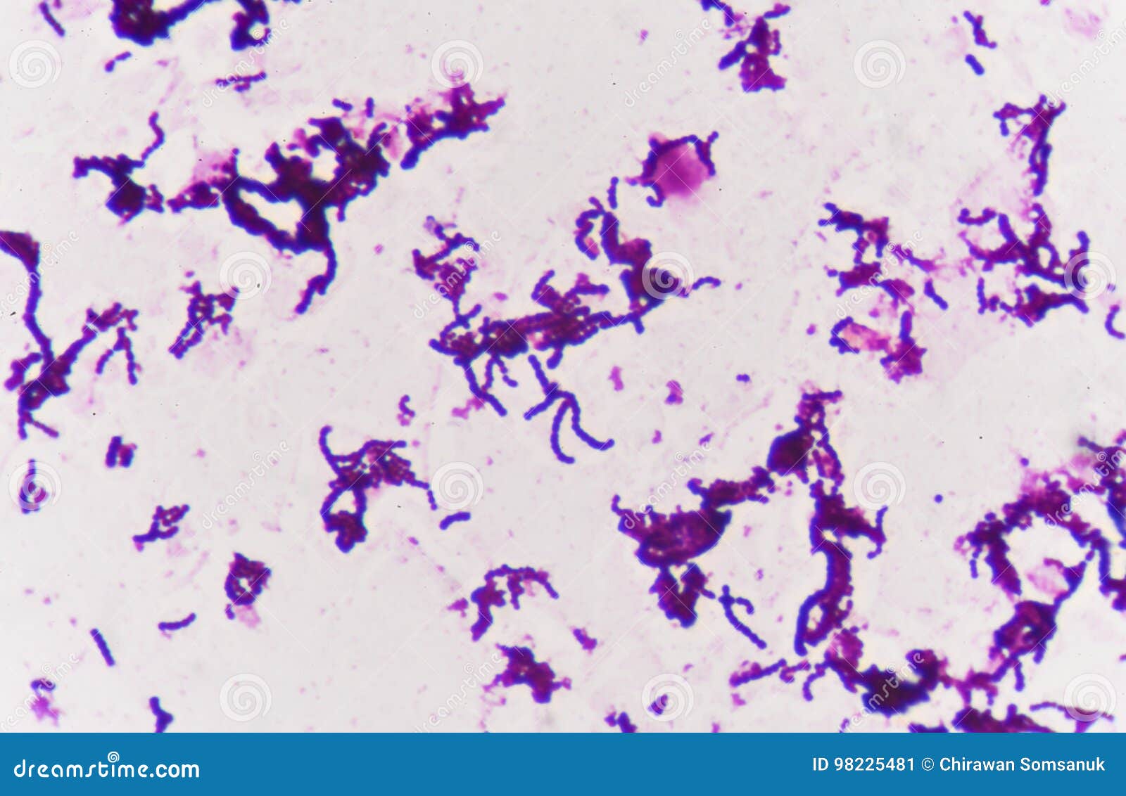 Streptococcus Thermophilus Gram Stain