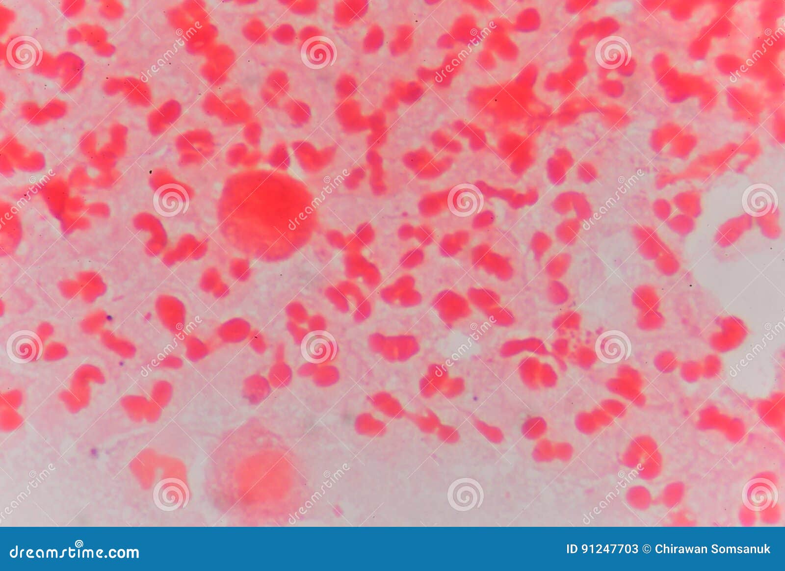 Gram Staining, Also Called Gram`s Method Stock Image - Image of ...