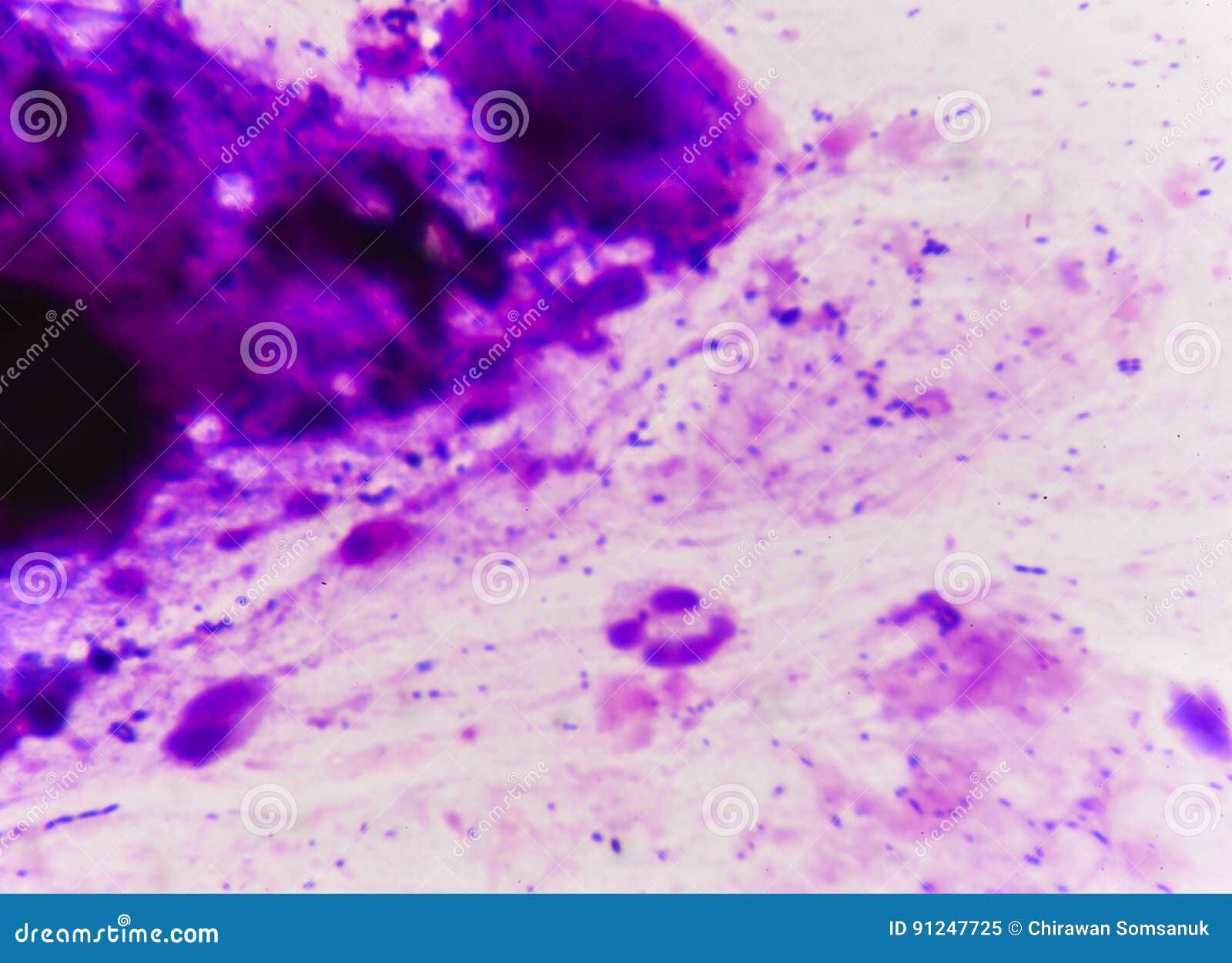 Gram Staining, Also Called Gram`s Method Stock Image - Image of disease ...