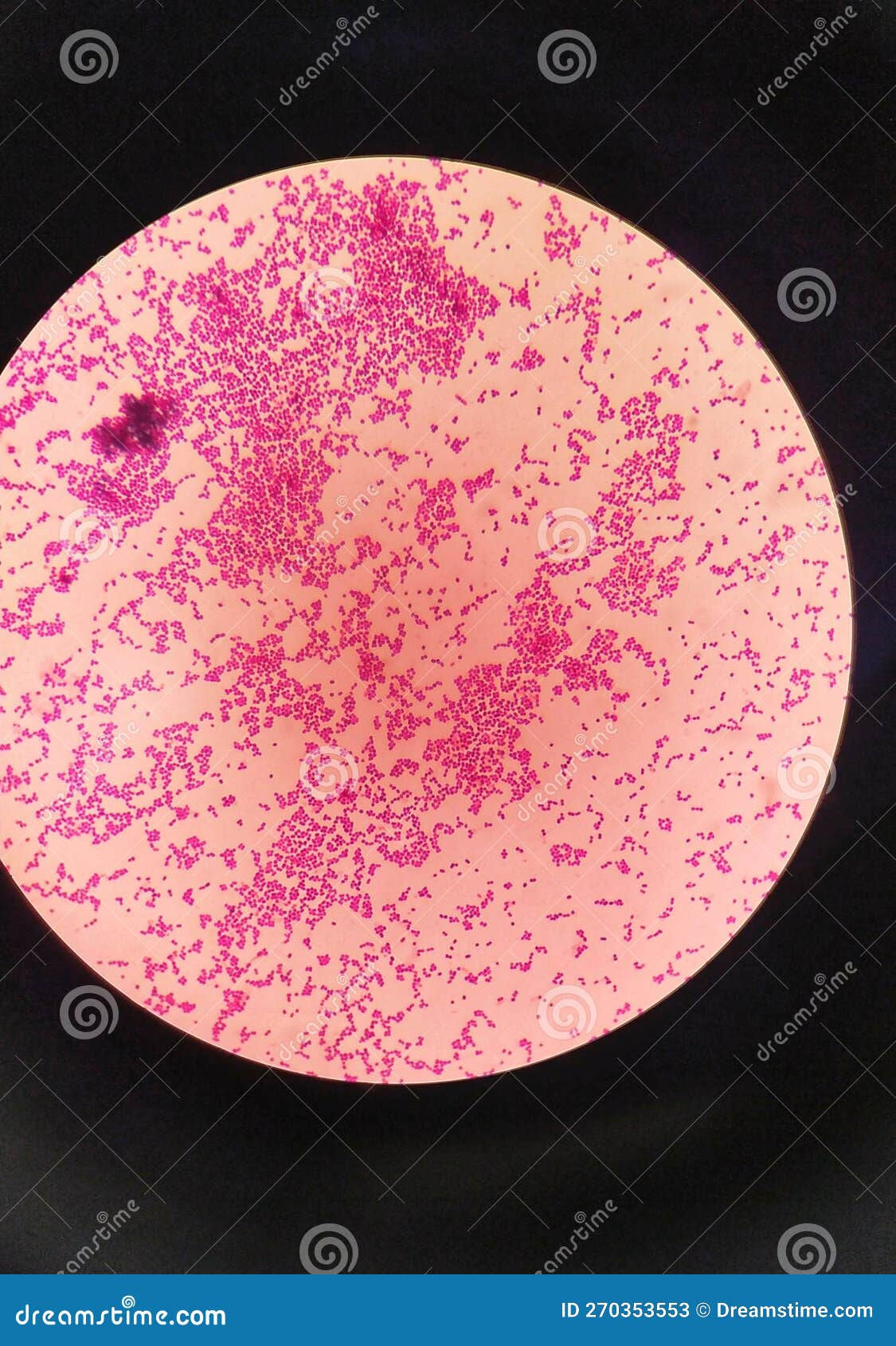 Gram Staining , Also Called Gram S Method, Gram Positive Coccus Stock ...
