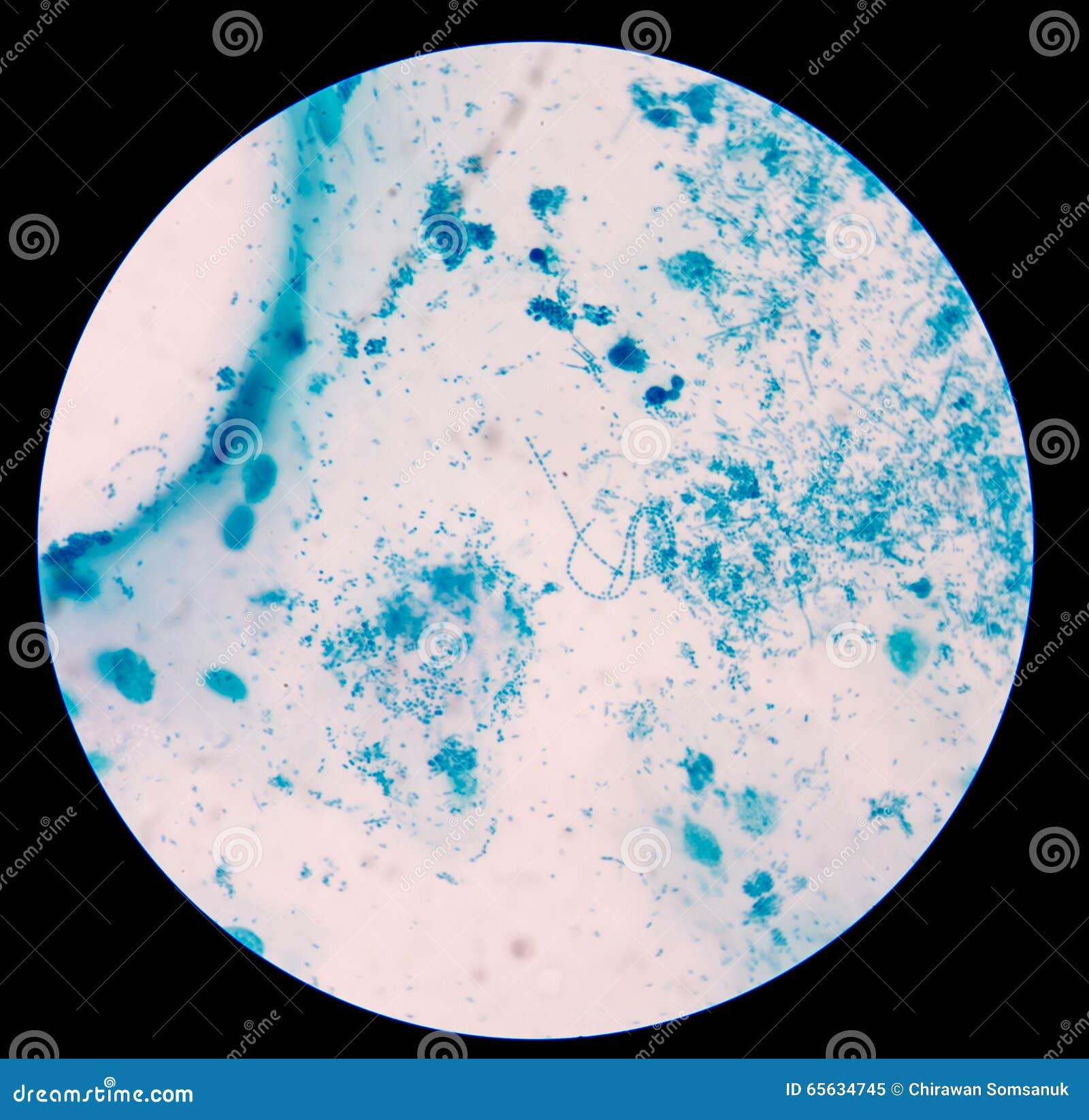 Gram Staining, Also Called Gram S Method, is a Method of Differe Stock ...