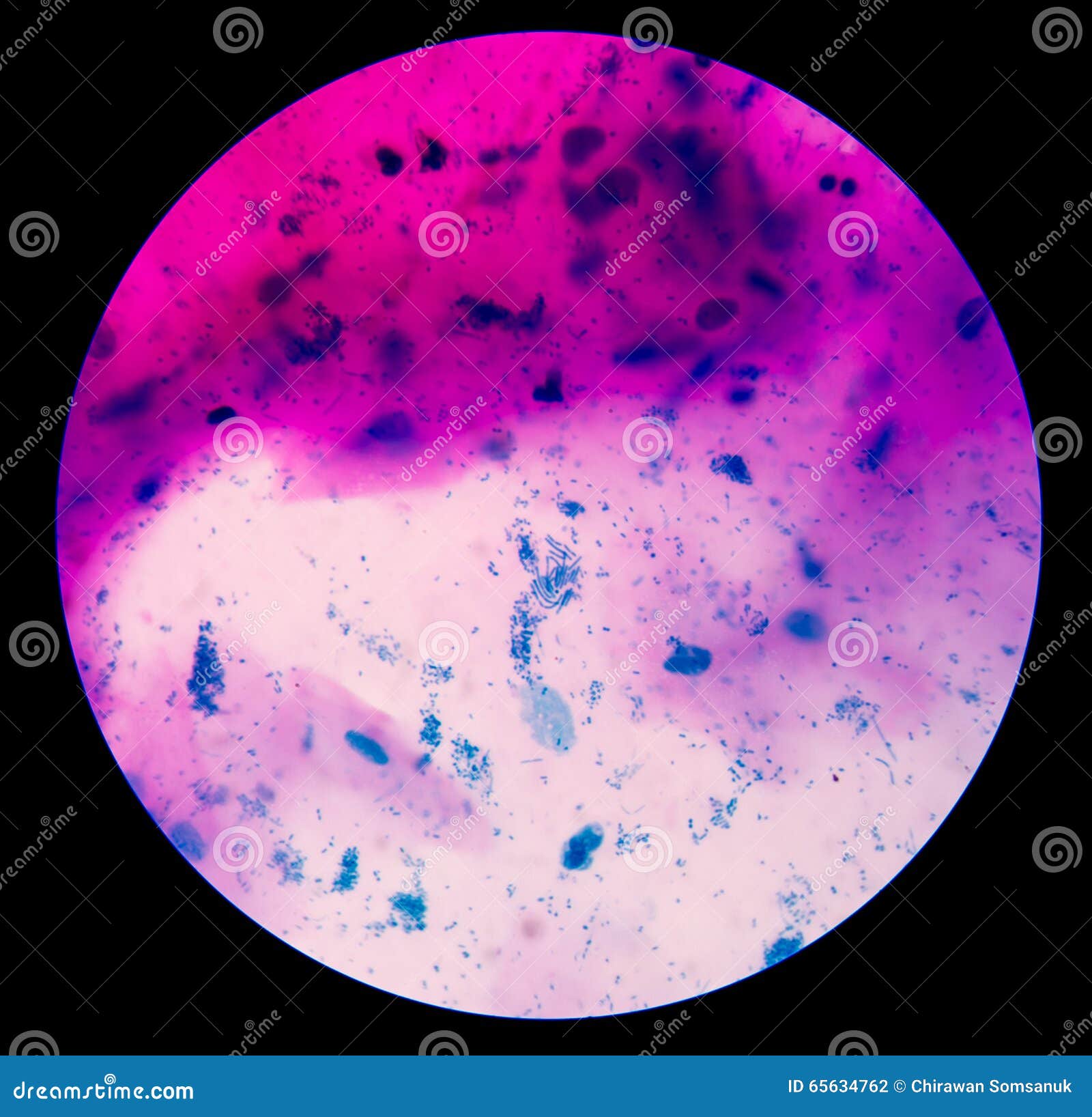 Gram Staining, Also Called Gram S Method, is a Method of Differe Stock ...
