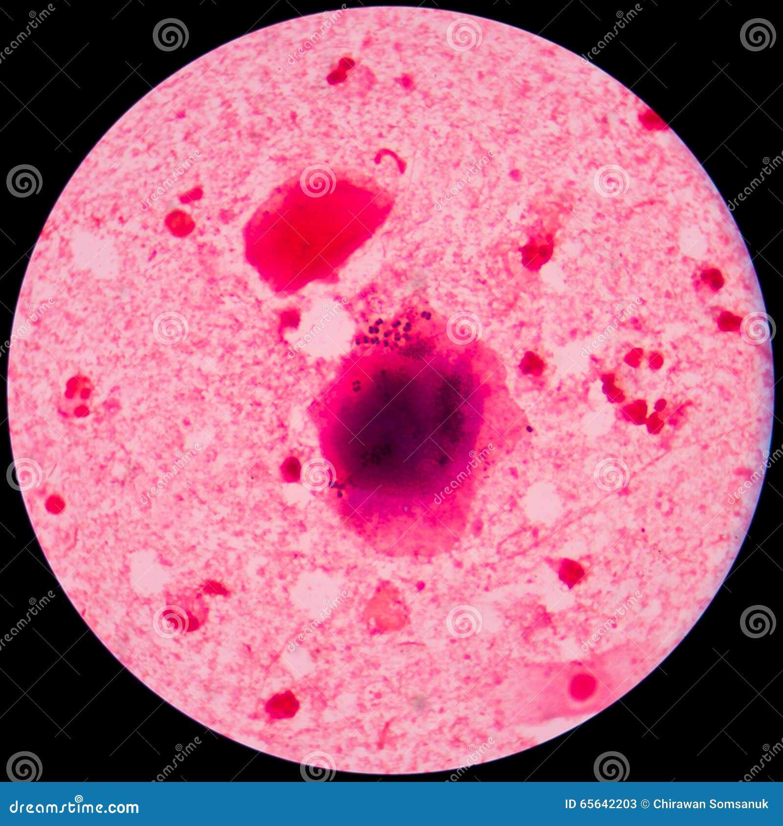 Gram Staining, Also Called Gram S Method, is a Method of Differe Stock ...