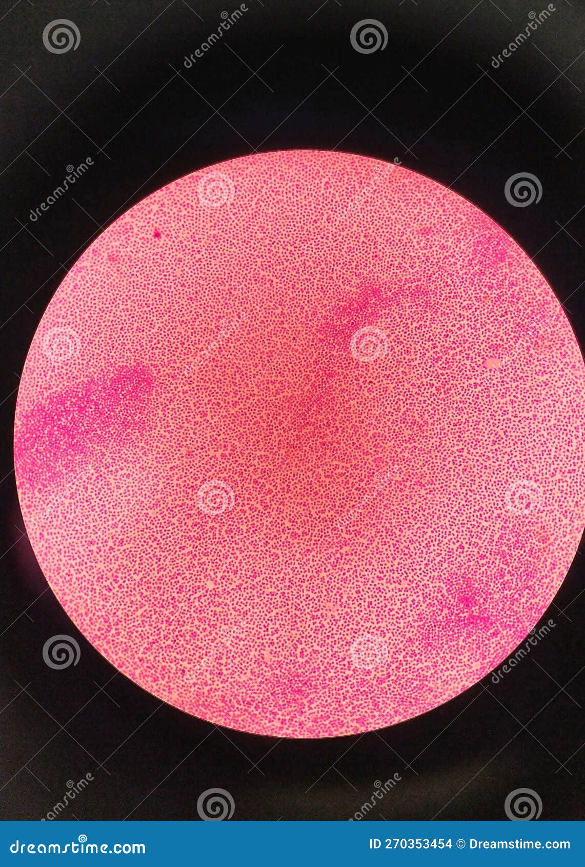Gram Staining , Is A Method Of Differentiating Bacterial Species. Gram ...