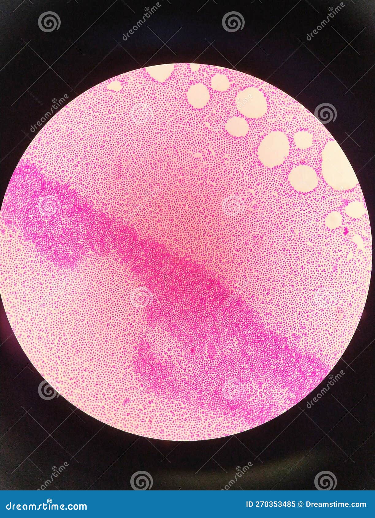 Gram Staining , is a Method of Differentiating Bacterial Species. Gram ...