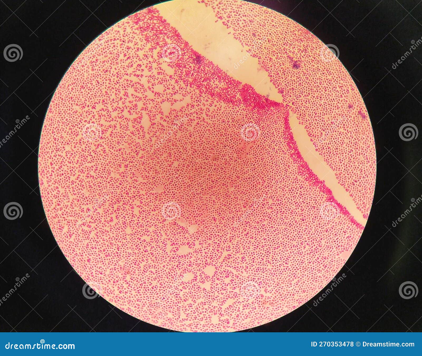 Gram Staining , is a Method of Differentiating Bacterial Species. Gram ...