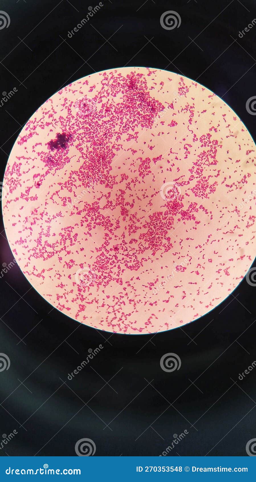 Gram Staining , Is A Method Of Differentiating Bacterial Species. Gram ...