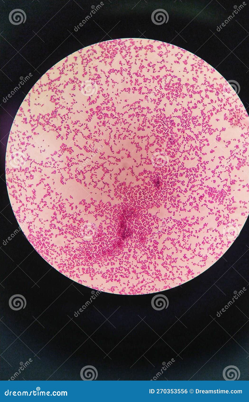 Gram Staining , Is A Method Of Differentiating Bacterial Species. Gram ...