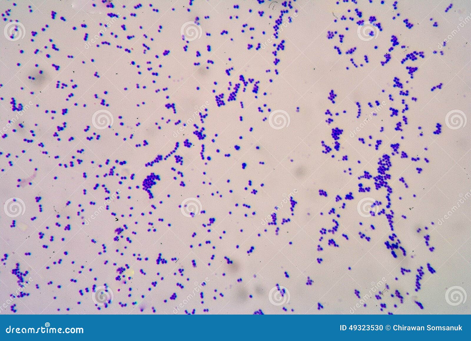 Gram staining stock photo. Image of organic, organism - 49323530