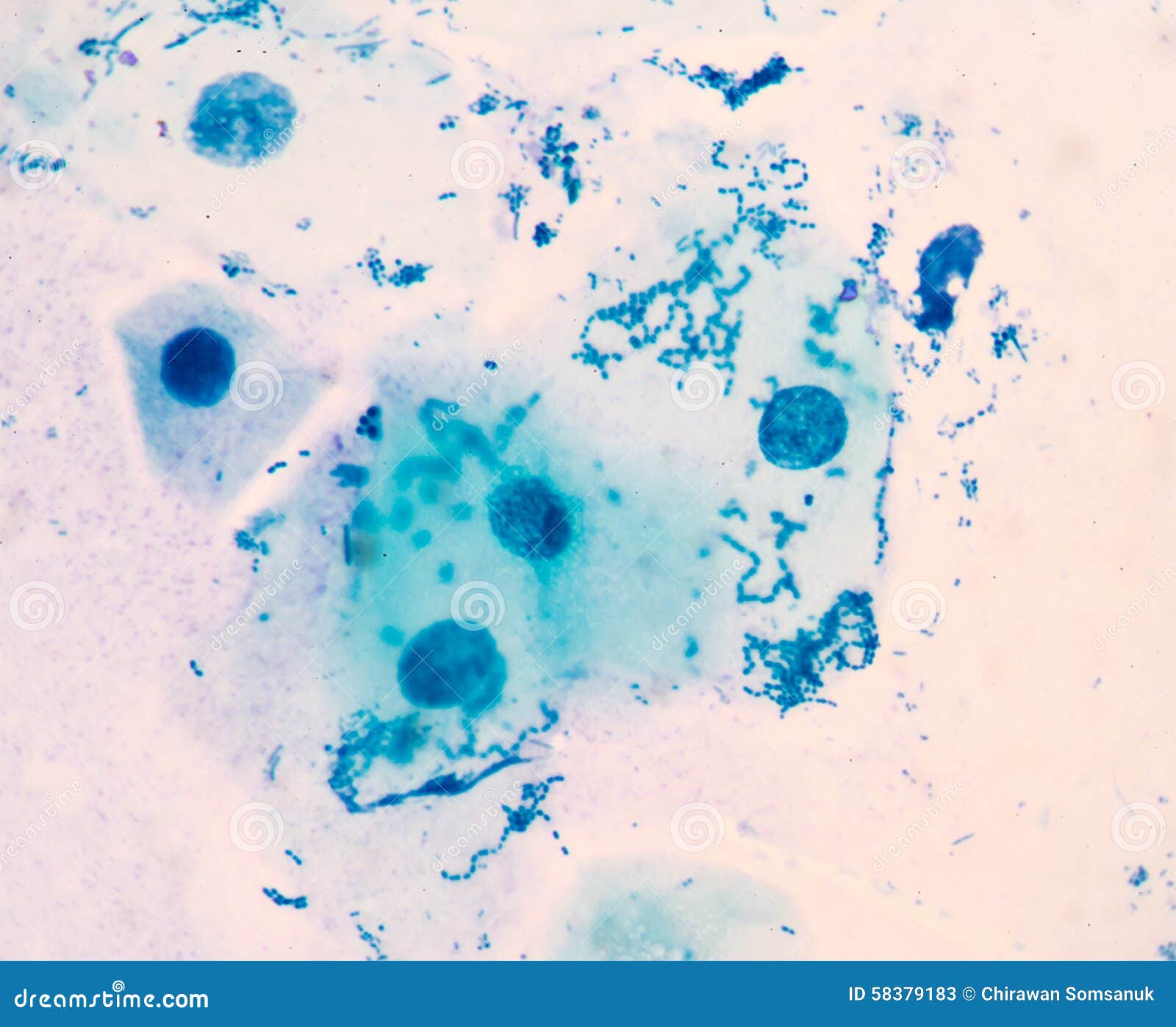 Bacillus Gram Positive Stain Under Microscope View. Bacillus Is Rod ...