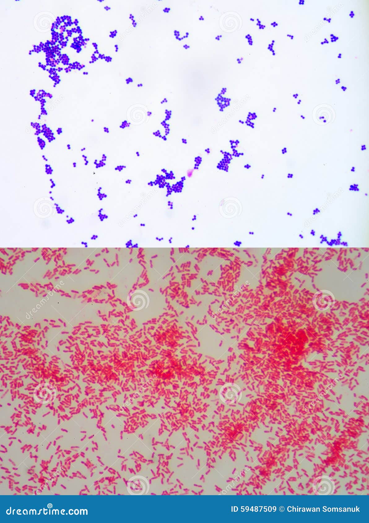 Bacillus Gram Positive Stain Under Microscope View. Bacillus Is Rod ...