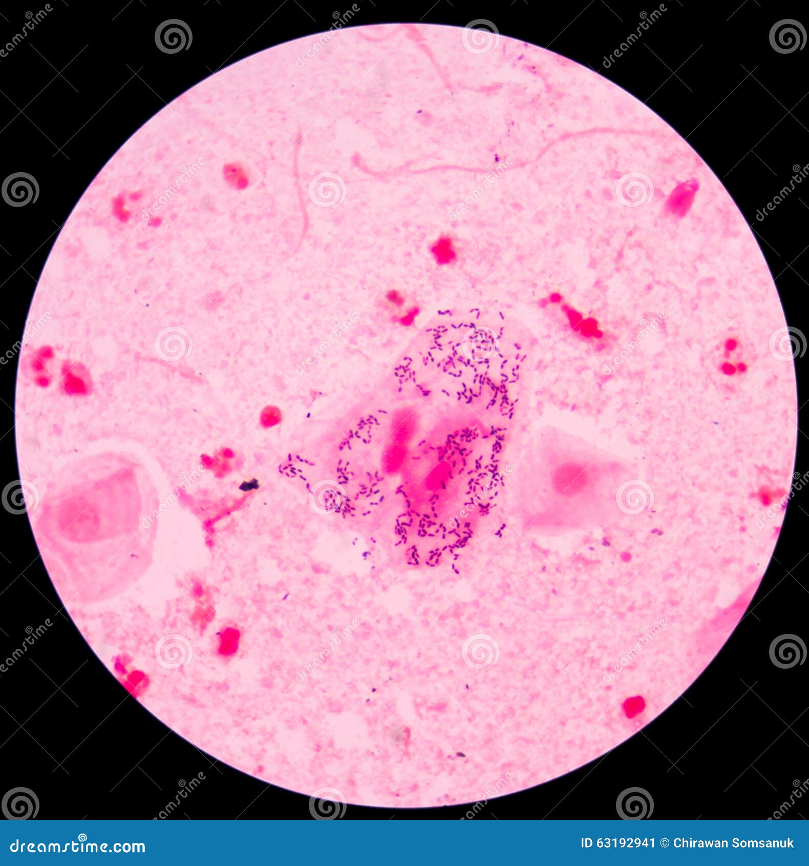 Bacillus Gram Positive Stain Under Microscope View. Bacillus Is Rod ...