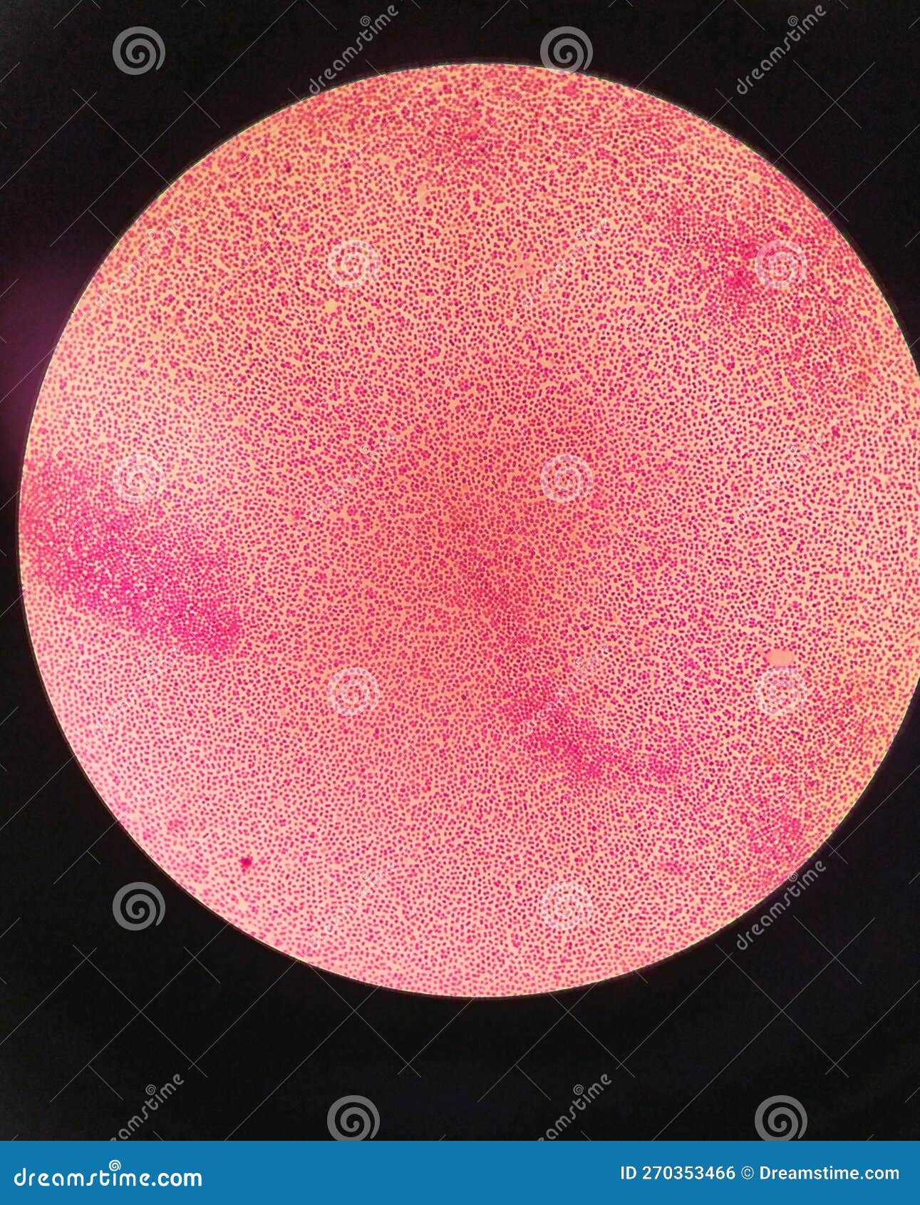 Gram Staining , is a Method of Differentiating Bacterial Species. Gram ...